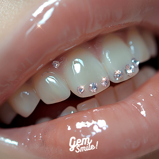 Strass Dentaire - Shop - Box GemSmile™ ️ (2025)