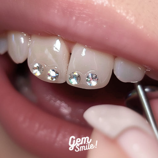 Strass Dentaire - Shop - Box GemSmile™ ️ (2025)